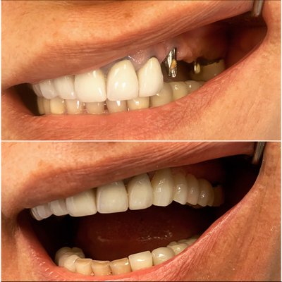 VARTAN TER POGHOSSIAN, DDS - Updated June 2026 - 33 Photos & 32 Reviews ...