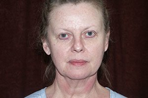 PARAMOUNT PLASTIC SURGERY - Updated October 2025 - 13 Photos & 10 ...