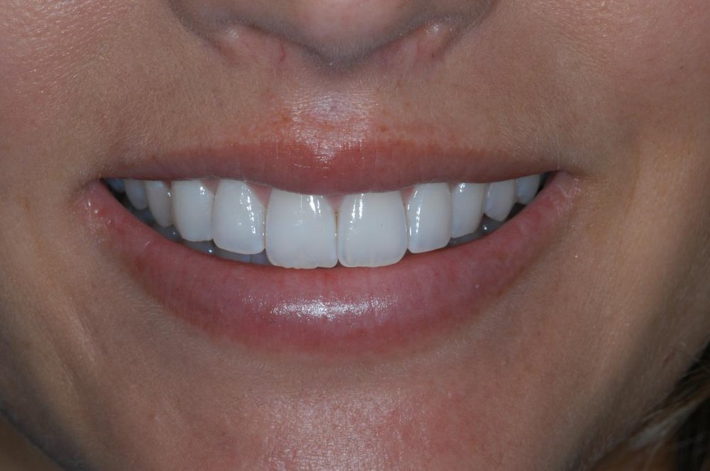 BRIAN M ASSAEL, DDS - Updated December 2025 - 39 Reviews - 2459 Ashby ...