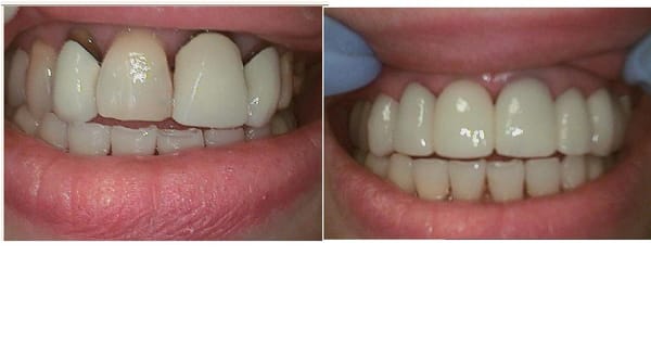 CHRISTOPHER CHOW, DDS - Updated May 2026 - 40 Photos & 111 Reviews ...