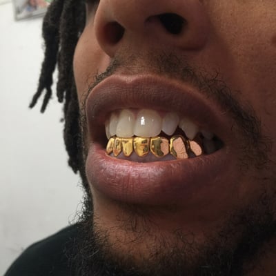 REAL MIKE GOLD TEETH - Updated December 2025 - 8315 NW 22nd Ave, Miami ...