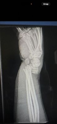 ROTHMAN ORTHOPAEDICS - Updated December 2025 - 13 Photos - 265 E ...