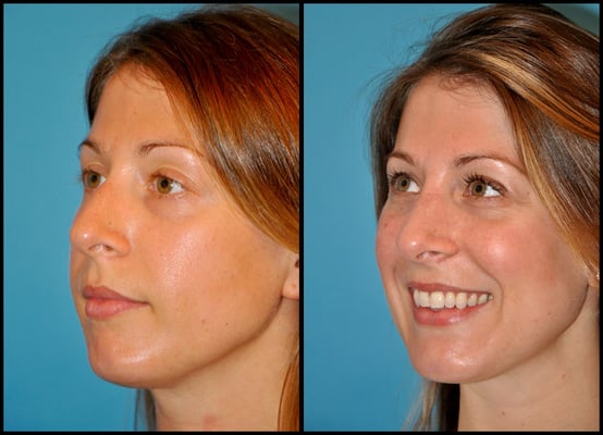 BARRY M. WEINTRAUB MD - Updated October 2025 - 64 Photos & 101 Reviews ...