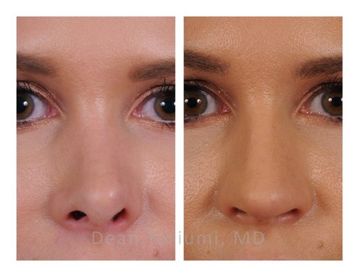 DEAN TORIUMI, MD - Updated September 2025 - 68 Photos & 48 Reviews - 60 ...