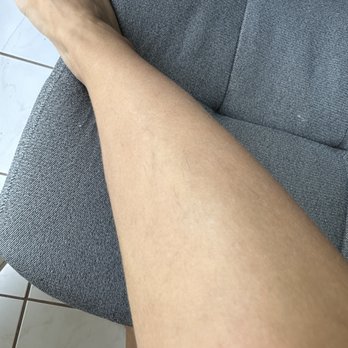 SEMPER LASER - Updated September 2025 - 56 Photos & 39 Reviews - 801 N ...