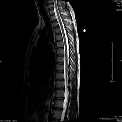 OPENSIDED MRI OF DENVER - Updated December 2025 - 13 Photos & 18 ...