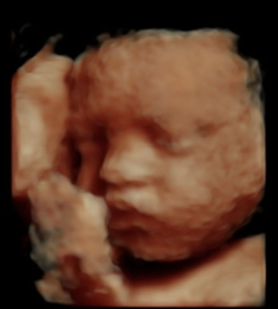 BABYVISION ULTRASOUND - Updated July 2025 - 34 Photos & 66 Reviews ...