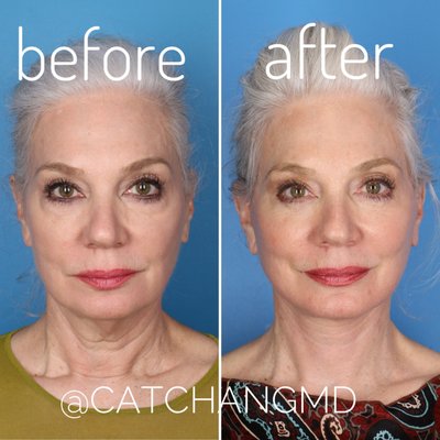 CATHERINE CHANG - Updated December 2025 - 13 Photos & 35 Reviews - 9735 ...