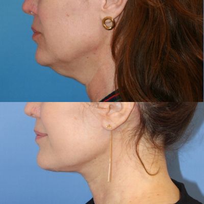 EVAN RANSOM, MD - Updated December 2025 - 126 Photos & 241 Reviews ...