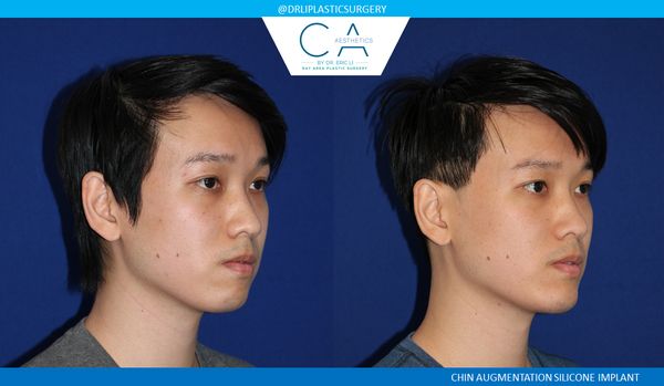 ERIC LI, MD - CA AESTHETICS - Updated May 2026 - 67 Photos & 41 Reviews ...