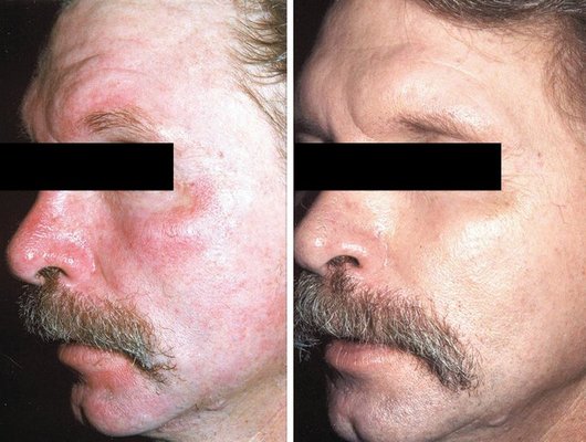 DERMATOLOGY & SKIN CARE ASSOCIATES - Updated August 2025 - 24 Reviews ...