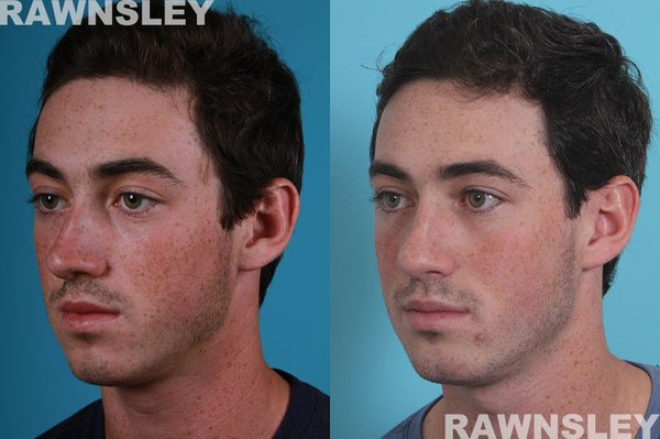 JEFFREY RAWNSLEY, MD - RAWNSLEY PLASTIC SURGERY - Updated September ...