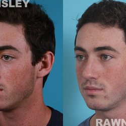 JEFFREY RAWNSLEY, MD - RAWNSLEY PLASTIC SURGERY - 61 Photos & 76 ...