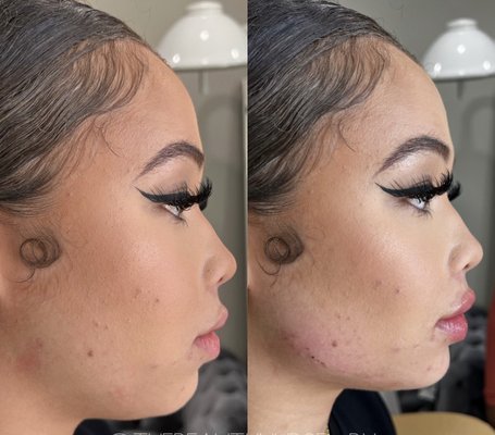 REGEN RX THERAPY - Updated December 2025 - 39 Photos - 3134 E ...