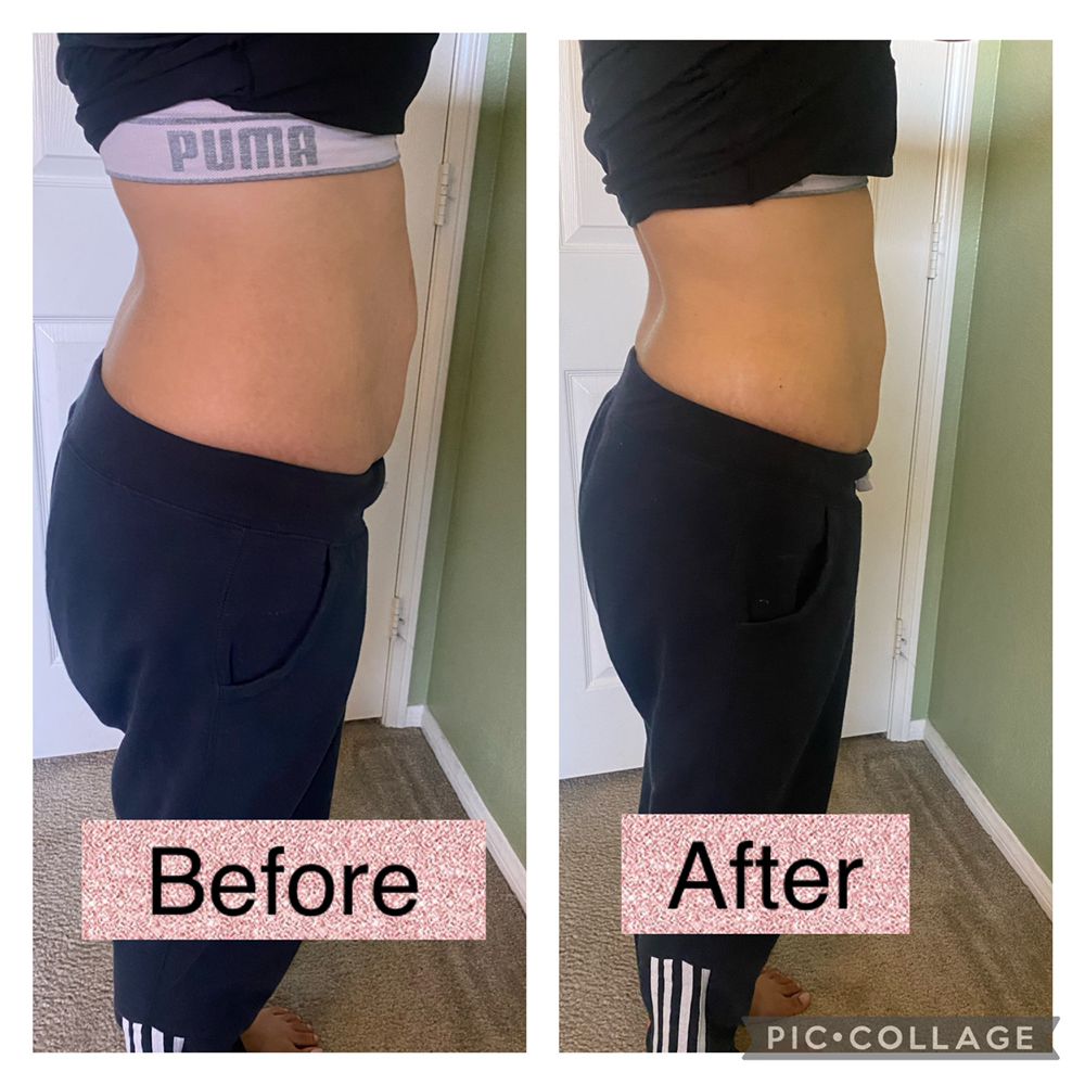 SNATCHED BODY SCULPTING - CLOSED - Updated August 2025 - 13 Photos ...