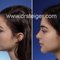 STEIGER FACIAL PLASTIC SURGERY: DR. JACOB D. STEIGER - Updated December ...