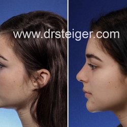 STEIGER FACIAL PLASTIC SURGERY - 19 Photos & 32 Reviews - Medical Spas ...