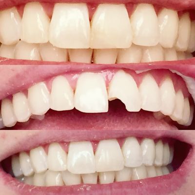 ADVANTA DENTAL - Updated September 2025 - 321 N Sequim Ave, Sequim ...