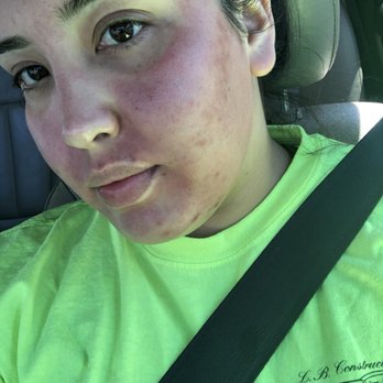 GLO MED SPA AUSTIN - Updated January 2025 - 101 Photos & 46 Reviews - 9801 Anderson Mill Rd ...