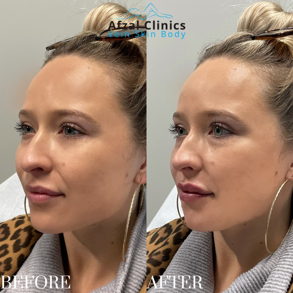 Phil Ecker's Instagram, Twitter & Facebook on IDCrawl