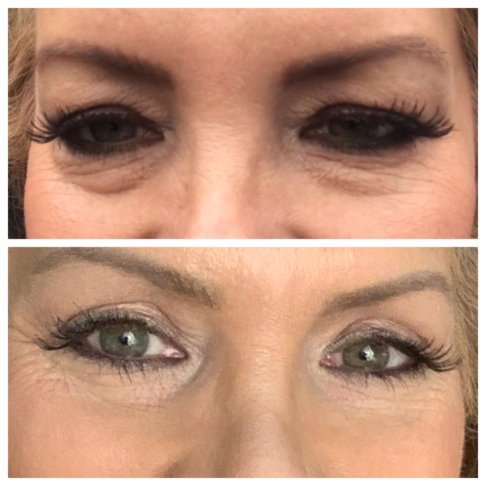 IRA VIDOR, MD - 12 Photos & 34 Reviews - Ophthalmologists - 366 San ...