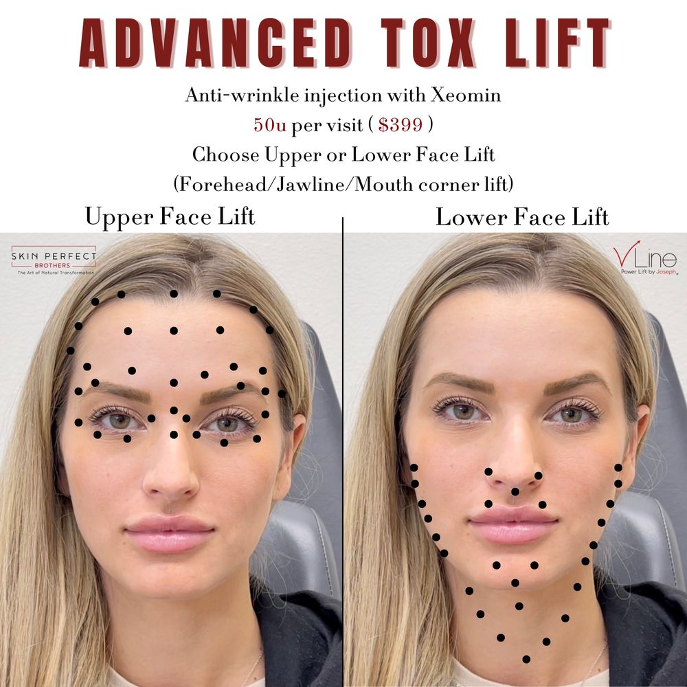 SKIN PERFECT BROTHERS - Updated December 2025 - 794 Photos & 588 ...