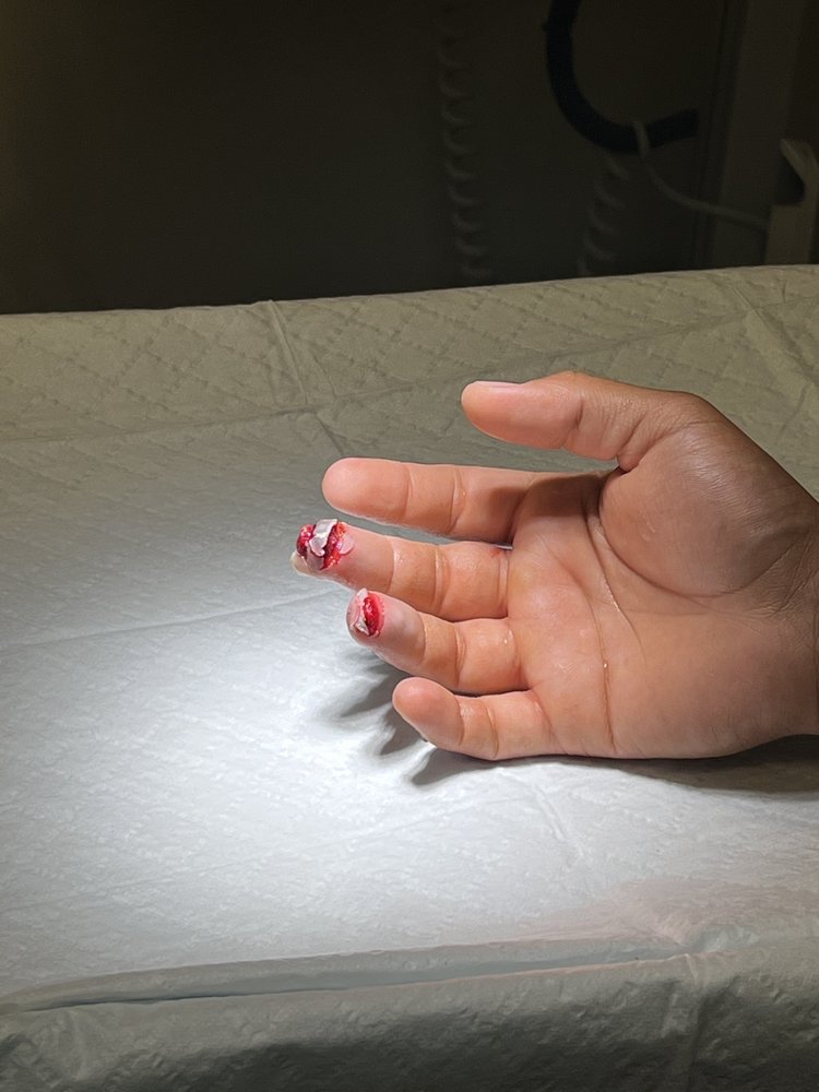 SUTTER ROSEVILLE MEDICAL CENTER EMERGENCY ROOM - Updated December 2024 ...