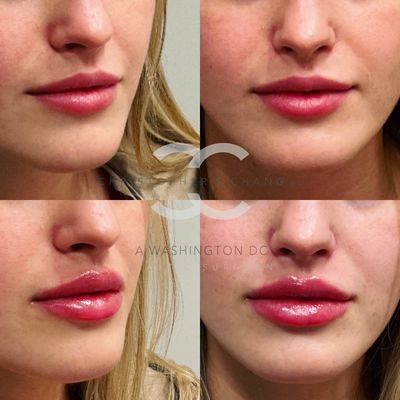 CONGRESSIONAL PLASTIC SURGERY | CHRISTOPHER C. CHANG, M.D - Updated ...