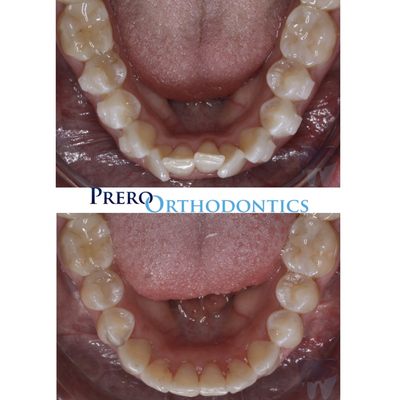 PRERO ORTHODONTICS - Updated November 2025 - 36 Photos & 196 Reviews ...