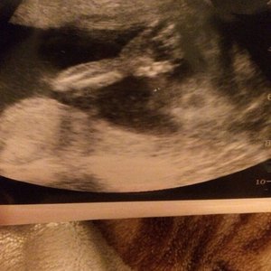 AKUMIN - Updated December 2025 - 13787 S Belcher Rd, Largo, Florida ...