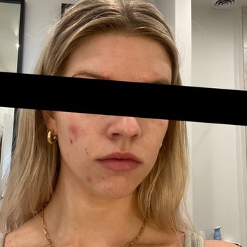 SPADERMA - Updated August 2024 - 118 Photos & 480 Reviews - 1133 W ...