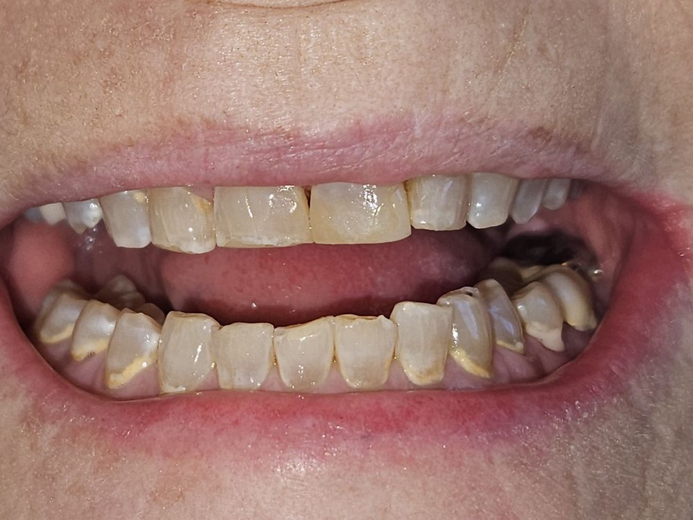 DR J TIM RAINEY DDS MAGD - Updated December 2025 - 606 Osage St, Refugio, Texas - General ...