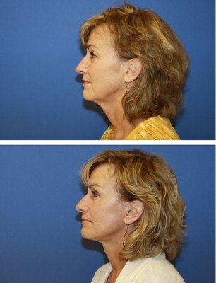 DAVID K FUNT, MD - Updated April 2025 - 23 Photos - 250 S Service Rd ...