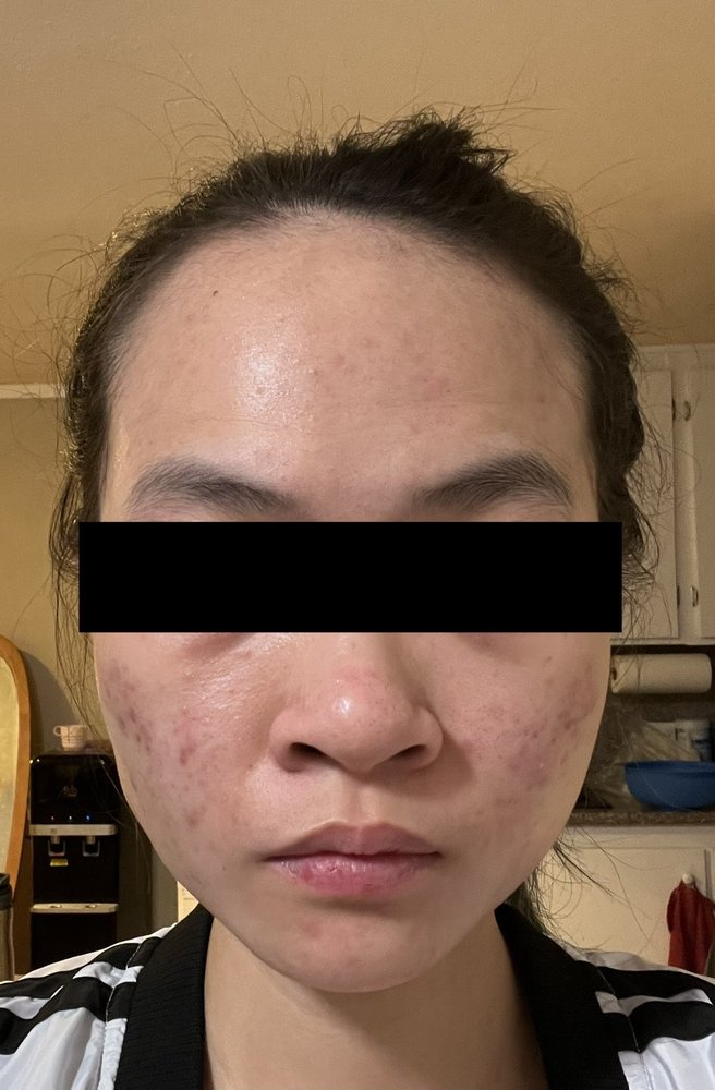 Oasis Skin Clinic - Trusted Since 2014 - Updated July 2025 - 68 Photos ...