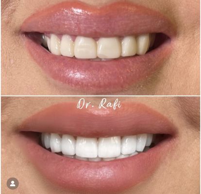 RAFI DENTAL GROUP - 46 Photos & 121 Reviews - 14591 Newport Ave, Tustin ...