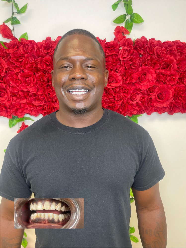 SUCCESS SMILES - Updated March 2026 - Southaven, Mississippi - Teeth ...