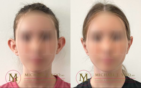 MICHAEL J YOO, MD - Updated June 2026 - 484 Photos & 103 Reviews - 1401 ...