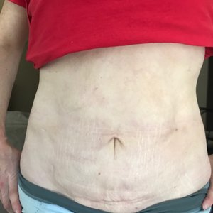 SONO BELLO - 32 Photos & 47 Reviews - Cosmetic Surgeons - 8200 E ...