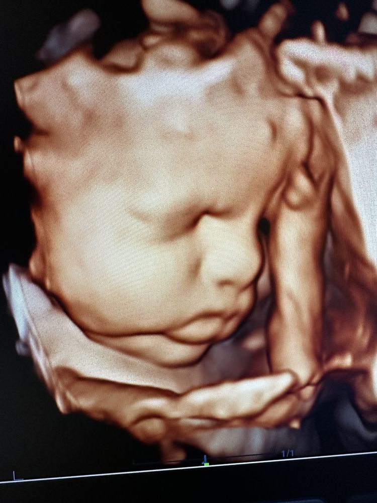 SWEET PEEK STUDIO - Updated September 2025 - 256 Poplar View Pkwy ...