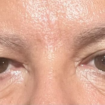 JEFFREY JOSEPH, MD - Updated May 2025 - 44 Photos & 94 Reviews - 5010 ...