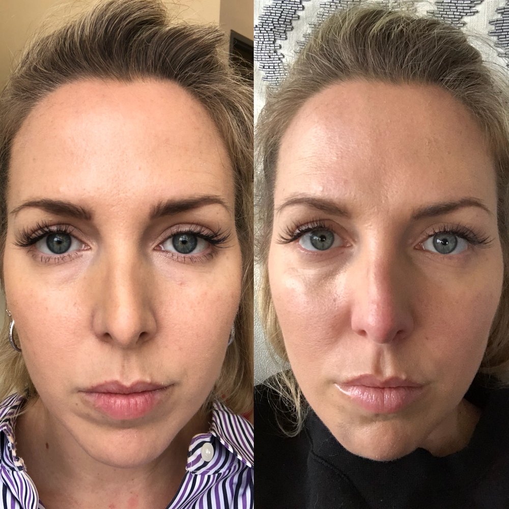 AMY LEWIS, MD - Updated June 2024 - 13 Photos & 21 Reviews - 120 E 75th ...