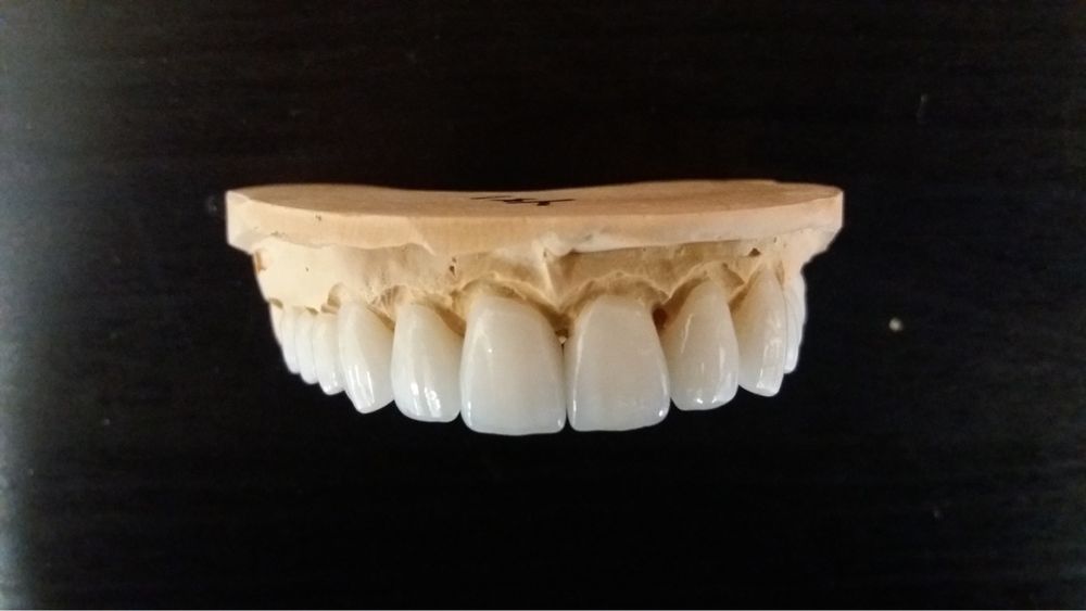 PRIME DENTAL LABORATORY - Updated June 2025 - 3715 51 Street SW ...