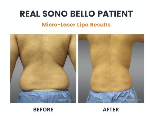 SONO BELLO CHARLOTTE - Updated January 2026 - 38 Photos & 33 Reviews ...