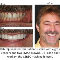 AL A FALLAH, DDS - 29 Photos & 25 Reviews - 1293 Carlsbad Village Dr ...