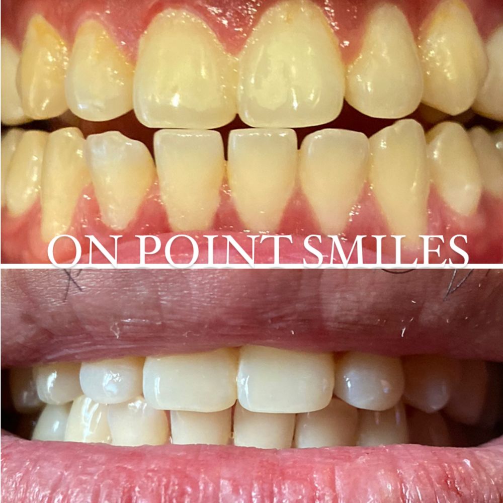 ON POINT SMILES - Updated December 2024 - 12 Photos - Las Vegas, Nevada ...