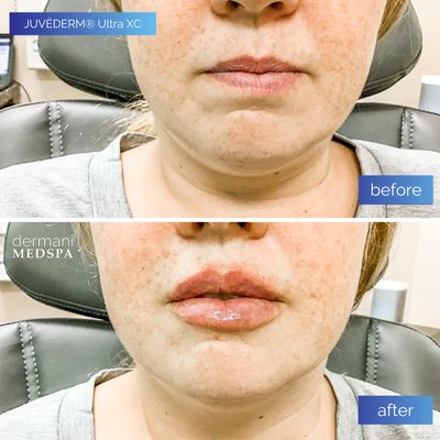 DERMANI MEDSPA - Updated 2024 - 95 Photos & 67 Reviews - 2900 Peachtree ...