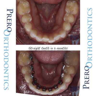 PRERO ORTHODONTICS - Updated January 2026 - 37 Photos & 197 Real ...