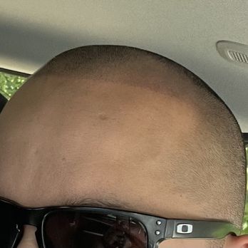 SKALP INK MICROPIGMENTATION - Updated December 2025 - 31 Photos - 9701 ...