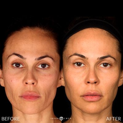 JASON EMER, MD - Updated December 2024 - 1071 Photos & 498 Reviews ...