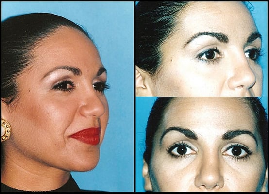 BARRY M. WEINTRAUB MD - Updated December 2025 - 64 Photos & 101 Reviews ...